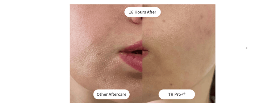 Case Studies – TR Pro
